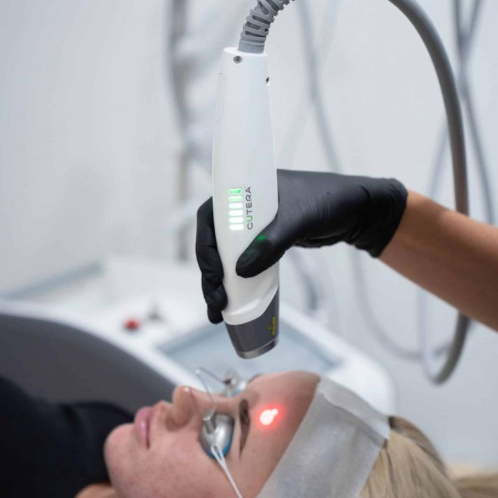 High Tech Skin Treatments